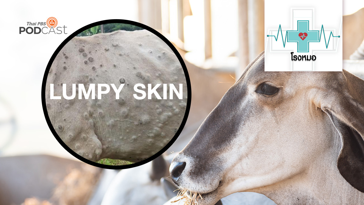 โรคลัมปี สกิน (Lumpy Skin) | Thai PBS Podcast | โรคลัมปี สกิน เป็นโรค ...